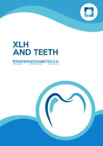 In XLH, not only the bones are affected, but also the teeth. With this ...